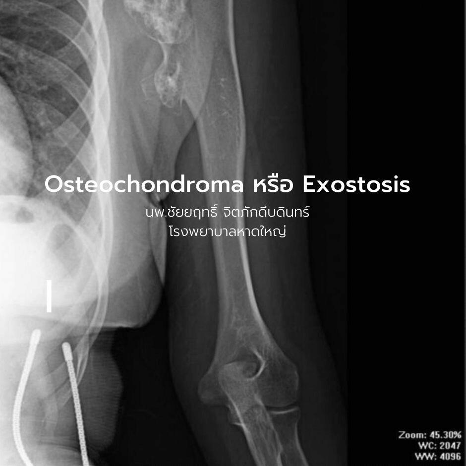 สมาคมออร์โธปิดิคส์แห่งประเทศไทย (The Thai Orthopaedic Association)| TOA ...